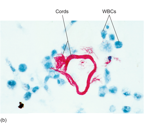Concerns Regarding The Ebola Virus